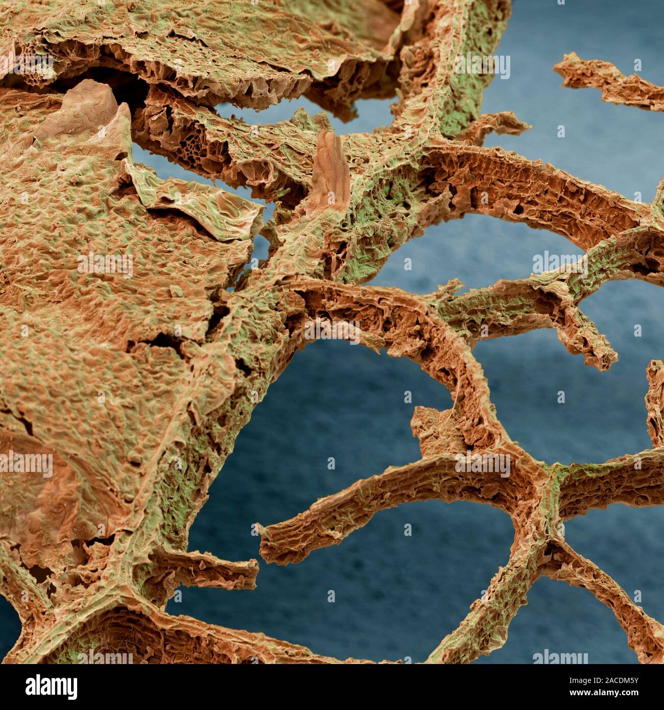 Leaf decay. Coloured scanning electron micrograph (SEM) of part of a ...