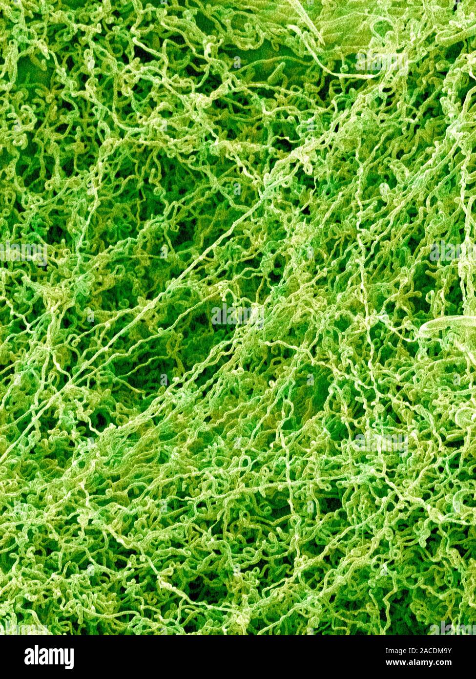 Nettle leaf. Coloured scanning electron micrograph (SEM) of tangled ...