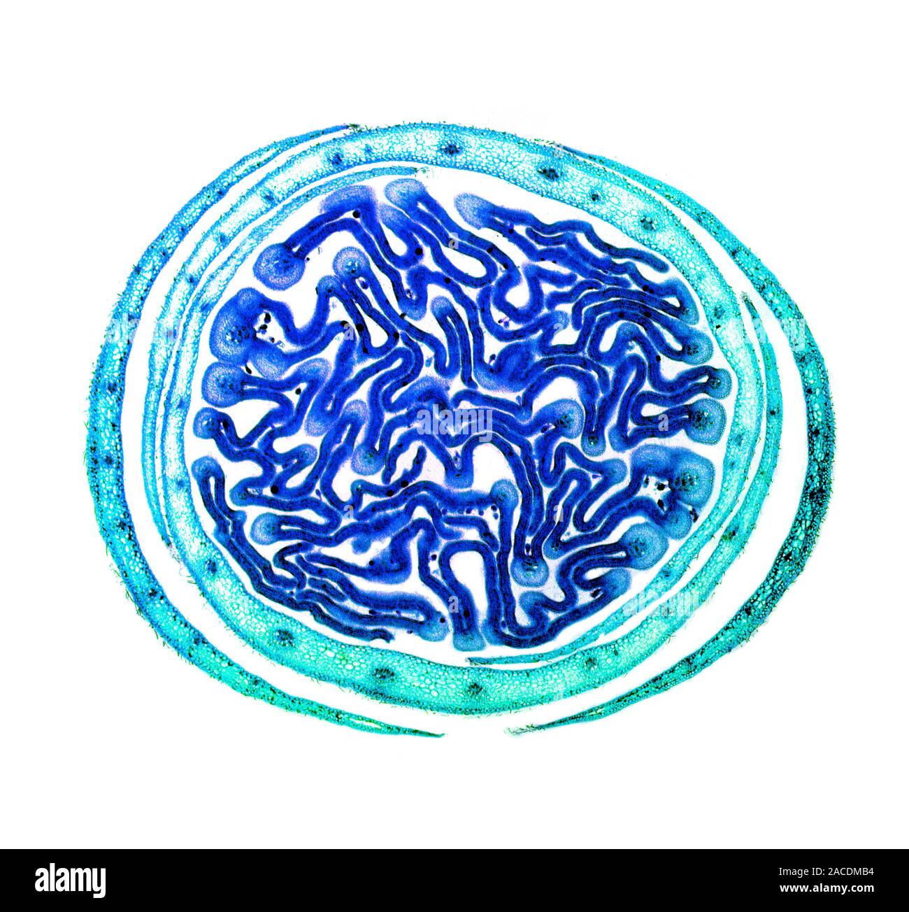 Leaf bud. Light micrograph of a cross-section through a winter leaf bud ...