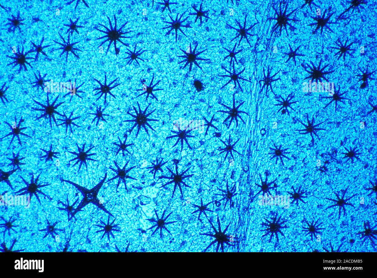 Stellate leaf hairs. Polarised light micrograph of the epidermis of a ...