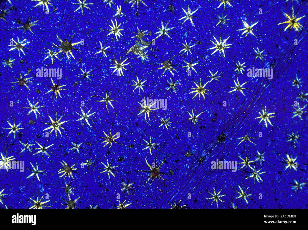 Stellate leaf hairs. Polarised light micrograph of the epidermis of a ...