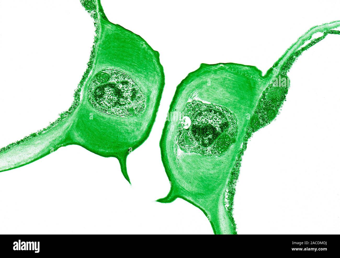 Leaf stoma. Coloured transmission electron micrograph (TEM) of a ...