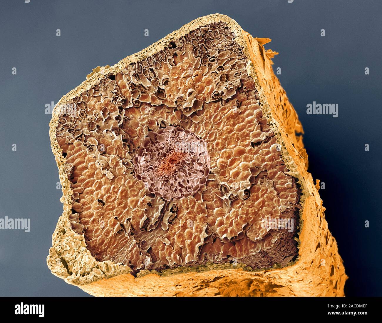 Conifer needle. Coloured scanning electron micrograph (SEM) of a ...