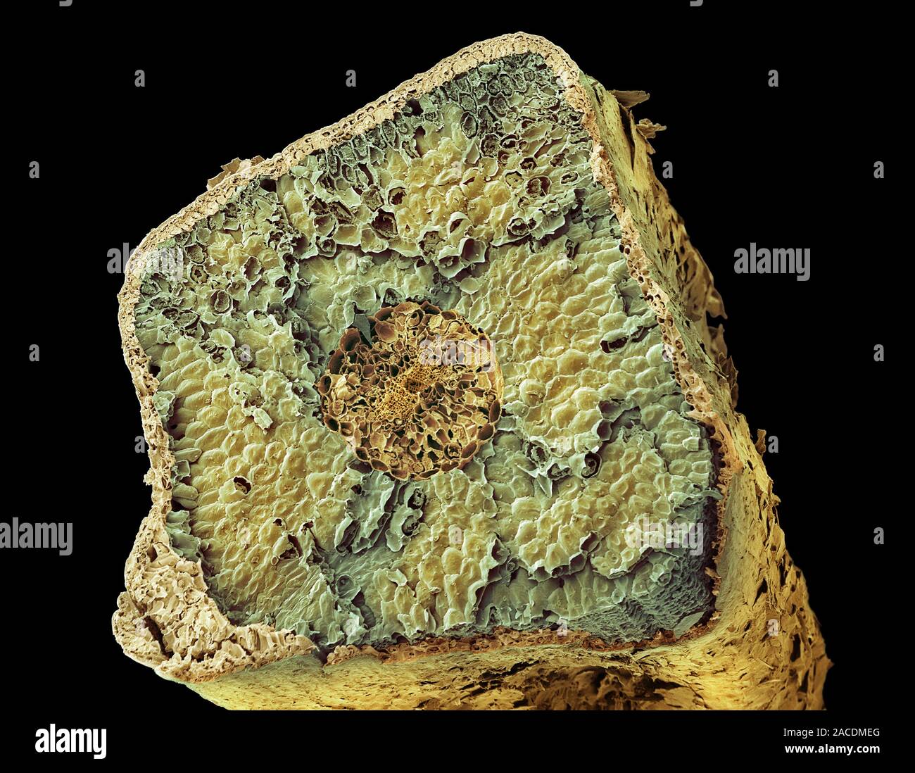 Conifer needle. Coloured scanning electron micrograph (SEM) of a ...