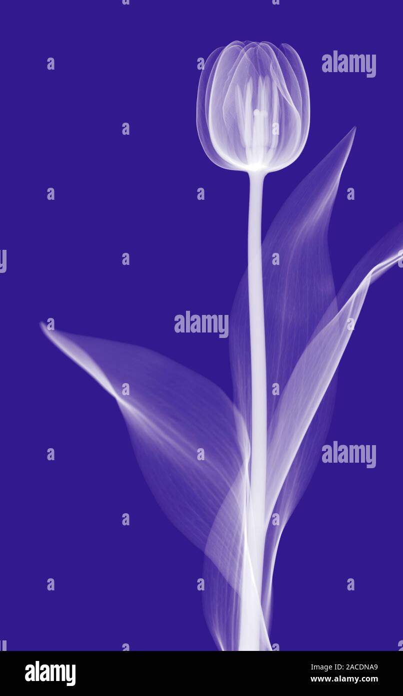 Tulip (Tulipa sp.), coloured X-ray Stock Photo - Alamy