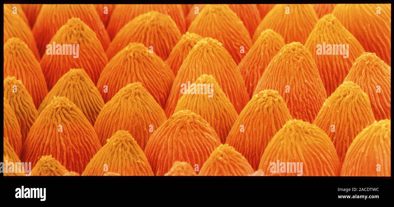 Rose petal. Coloured scanning electron micrograph (SEM) showing ...
