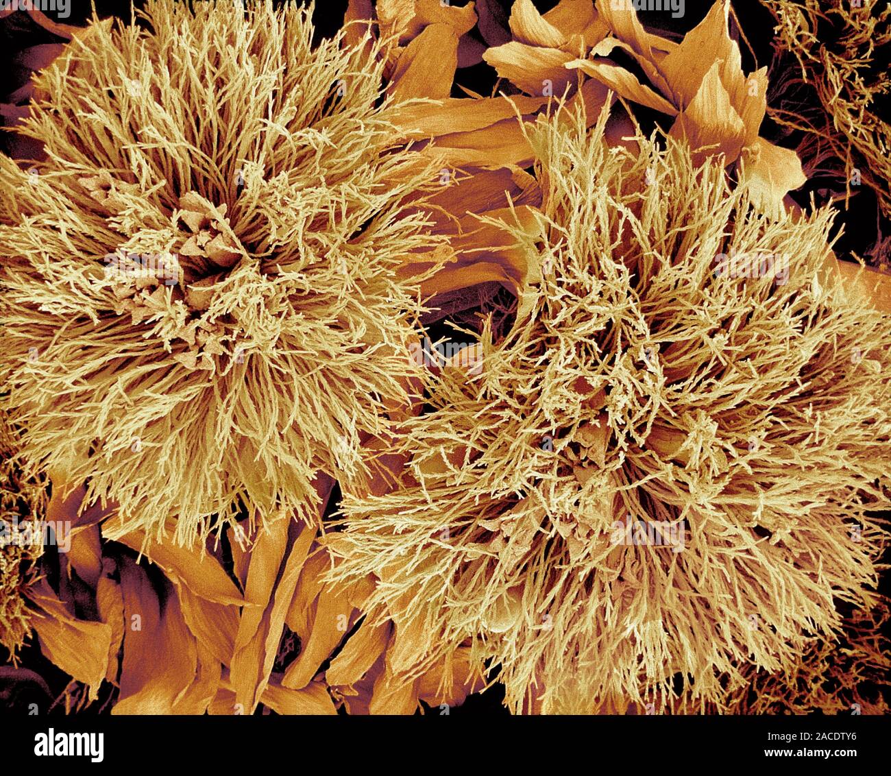 Withered flowers. Coloured scanning electron micrograph (SEM) of dying ...