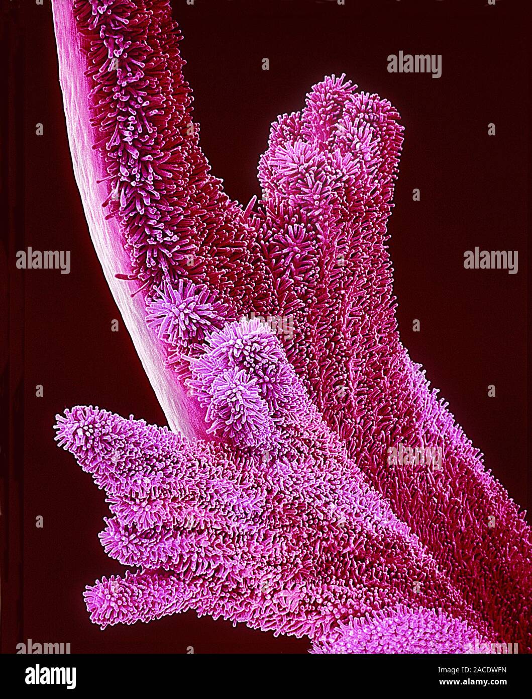 Carnation flower pistil. Coloured scanning electron micrograph (SEM) of ...