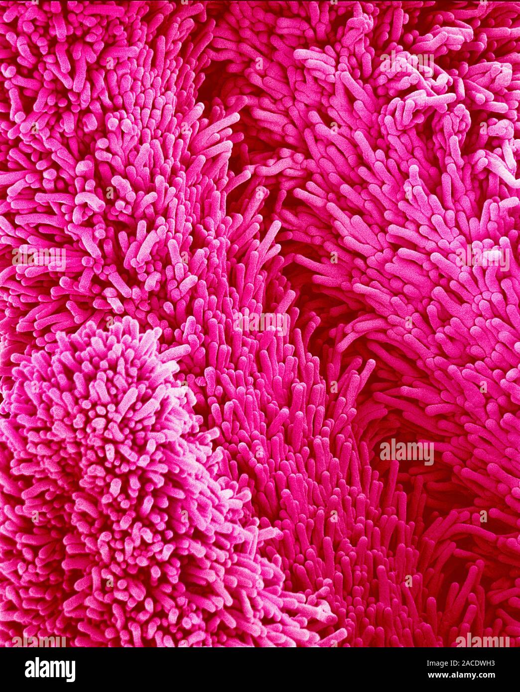 Easter cactus stigma. Coloured scanning electron micrograph (SEM) of ...
