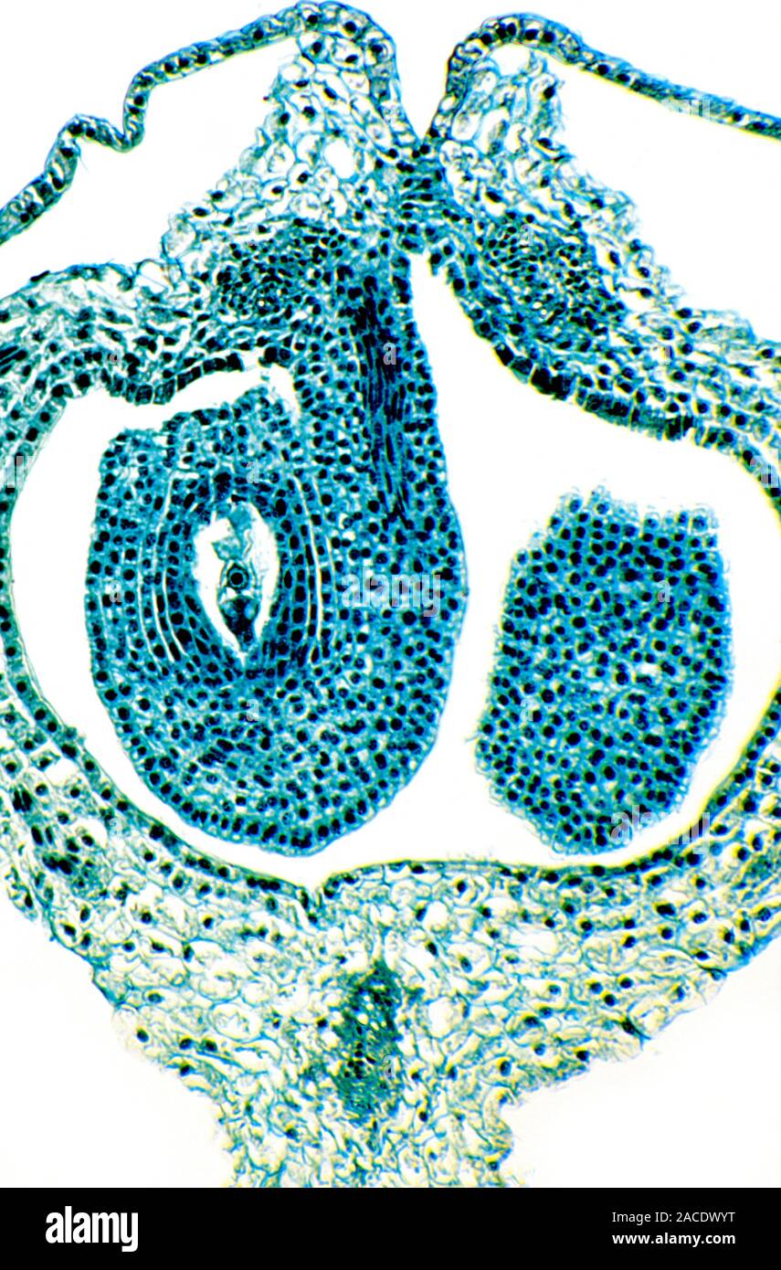 Marigold flower parts. Light micrograph of a vertical section through a ...