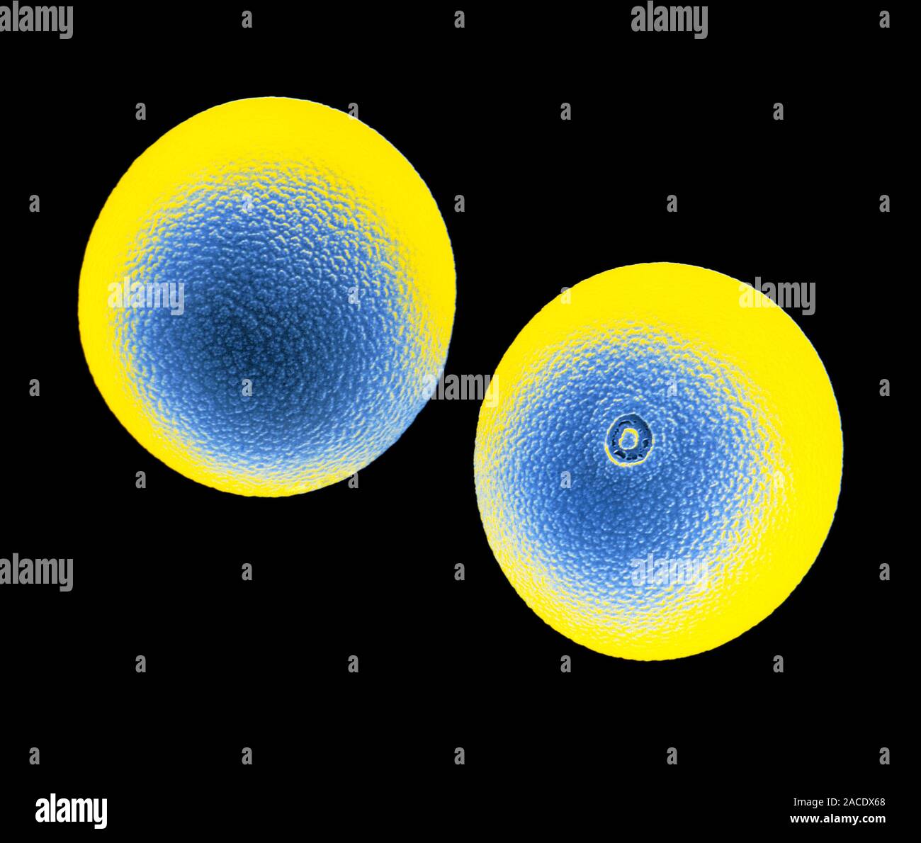 False-colour scanning electron micrograph (SEM) of two pollen grains of ...
