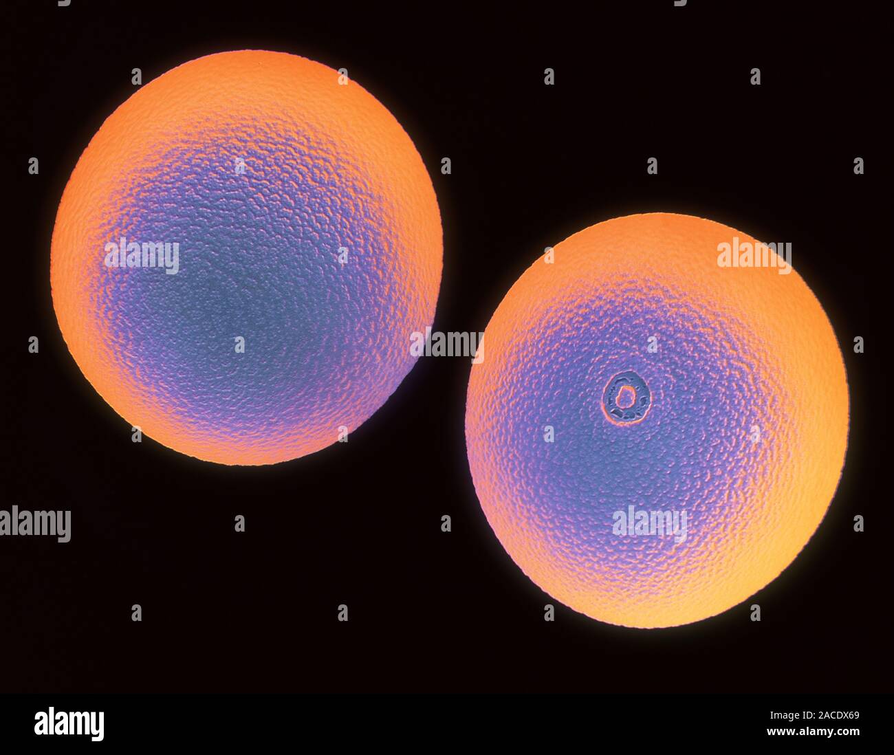 False-colour scanning electron micrograph (SEM) of two pollen grains of ...