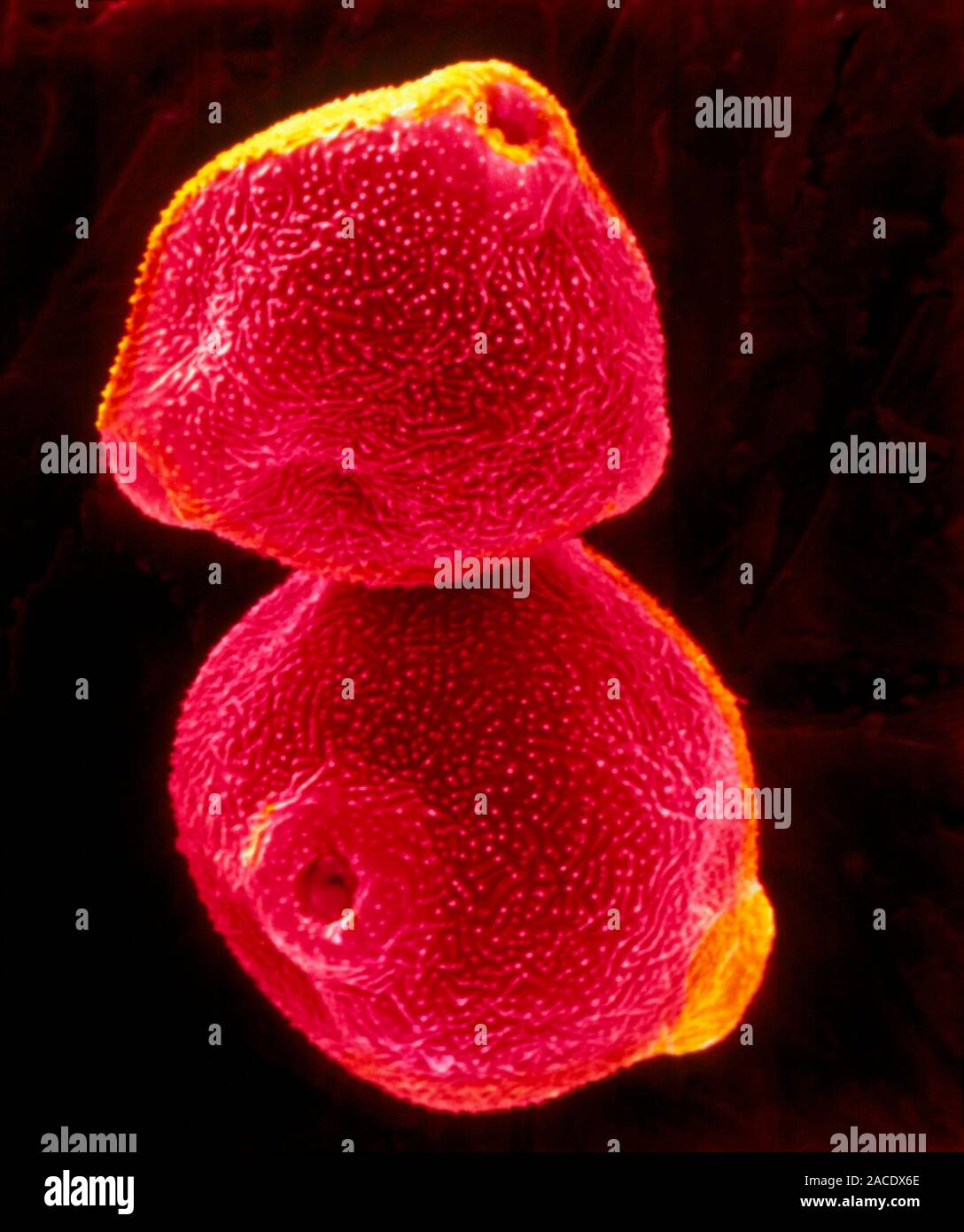 False-colour scanning electron micrograph of grains of birch tree ...