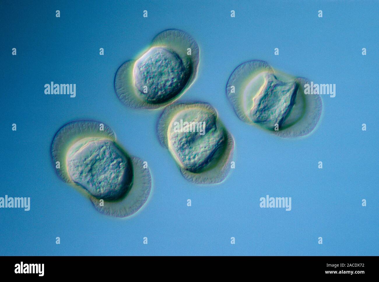 Light micrograph of winged pollen grains from a cedar of Lebanon tree ...