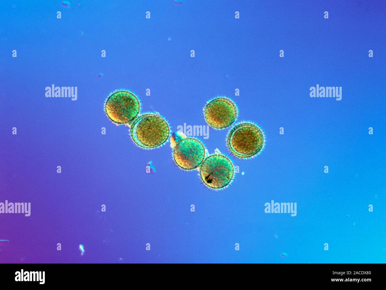 Light micrograph of pollen grains of the Malva plant (Malvaceae). The ...