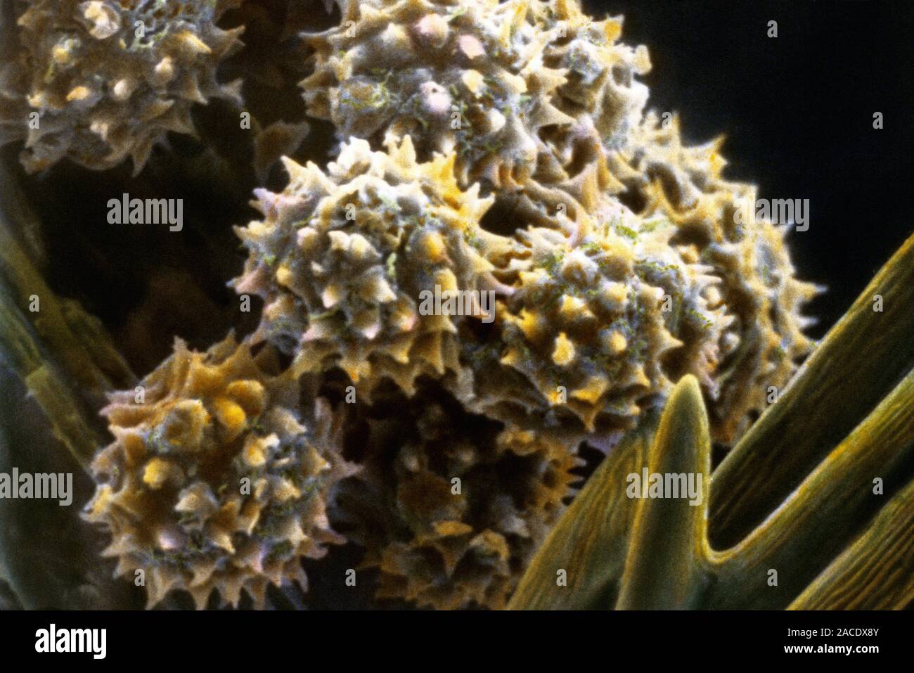 Goldenrod pollen. Coloured scanning electron micrograph (SEM) of pollen ...