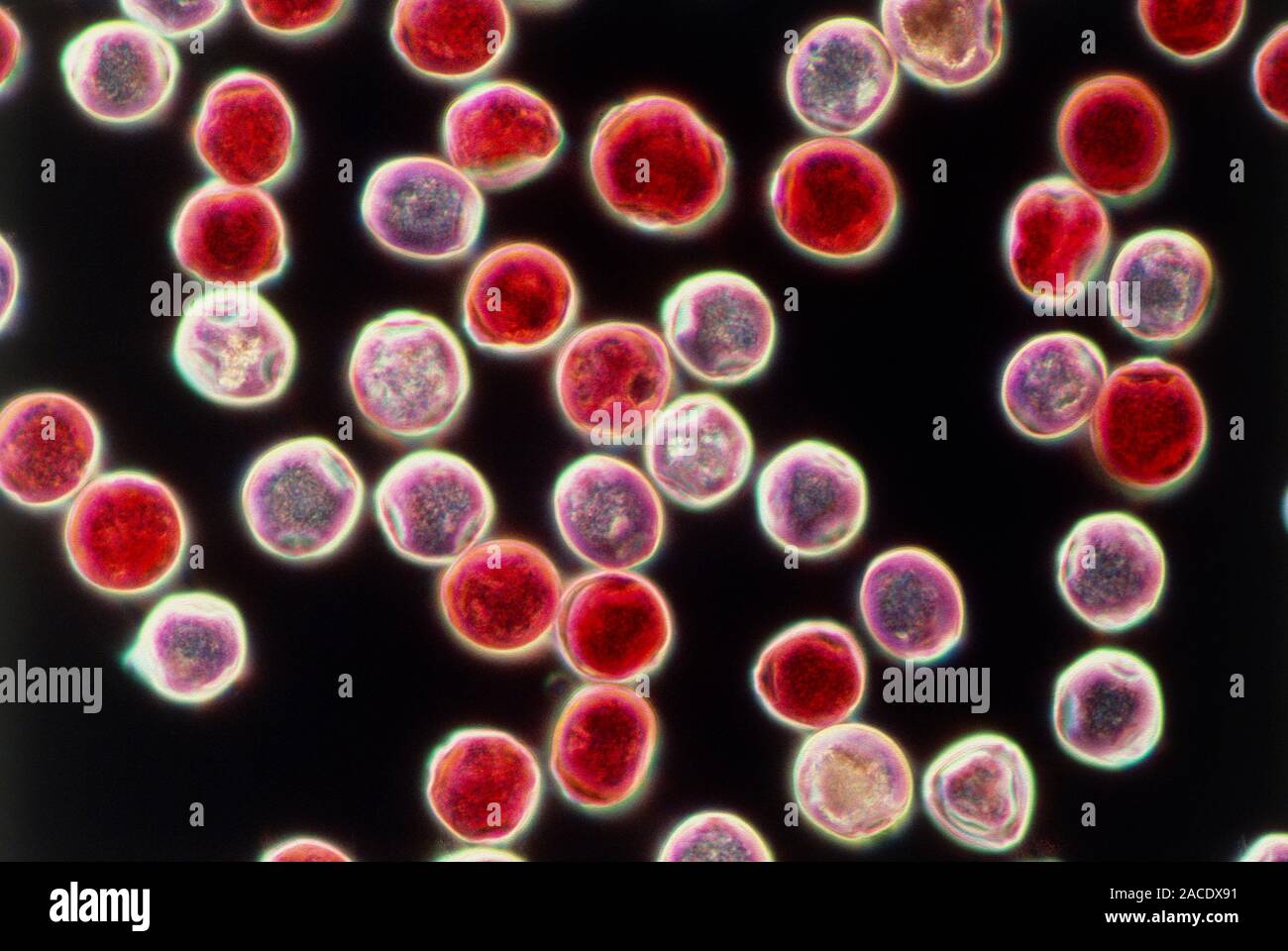Hazel pollen. Light micrograph of pollen grains from the Hazel tree ...