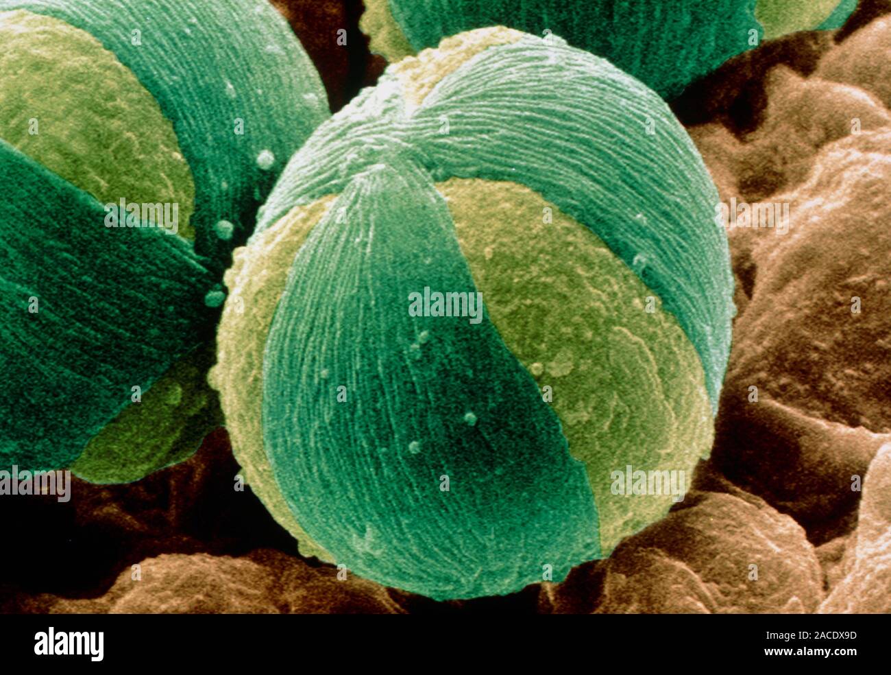 Pollen grain. Coloured scanning electron micrograph (SEM) of pollen ...