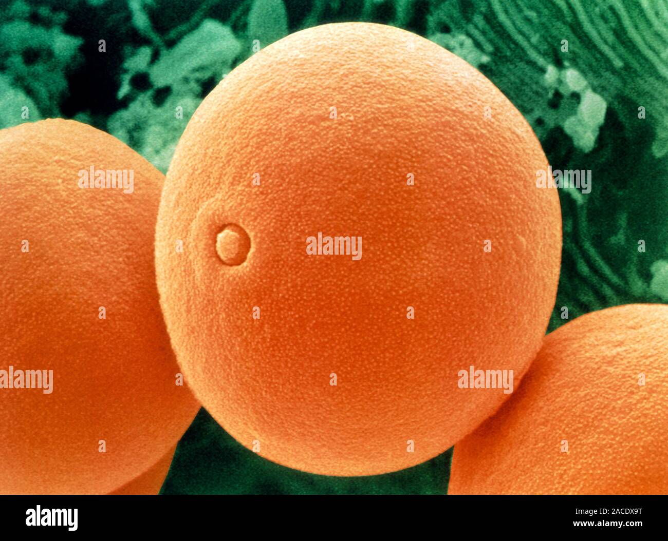 Timothy Grass Pollen Coloured Scanning Electron Micrograph Sem Of A Pollen Grain From Timothy