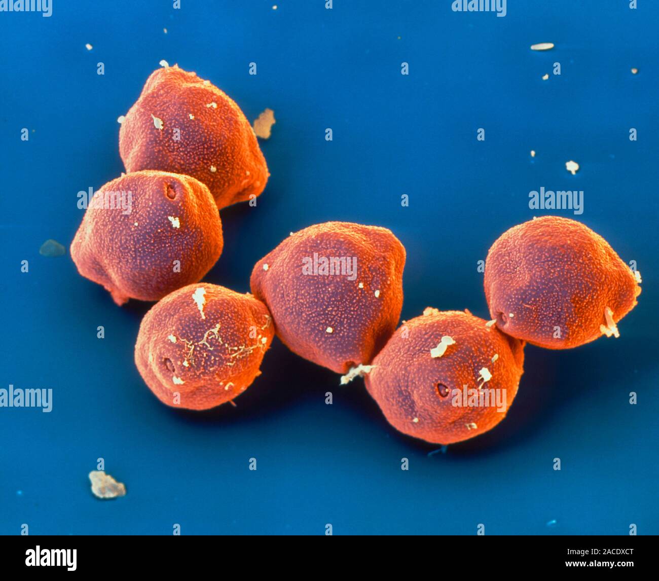 Hazel pollen grains. Coloured Scanning Electron Micrograph of pollen ...