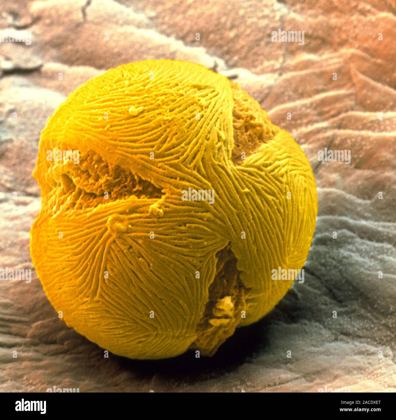 Sycamore pollen grain. Coloured scanning electron micrograph (SEM) of a ...