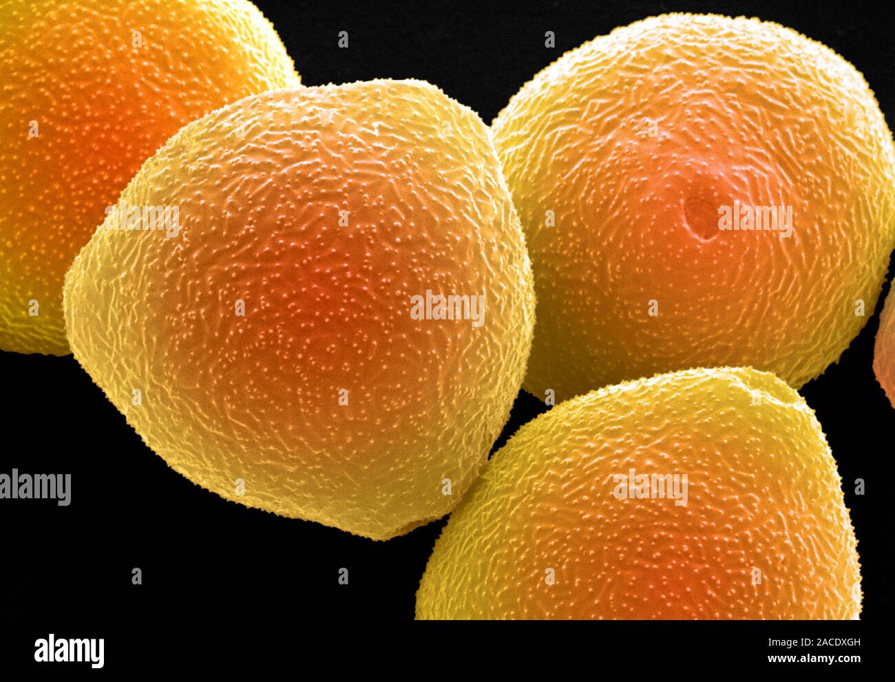 Hazel pollen grains. Coloured scanning electron micrograph (SEM) of ...
