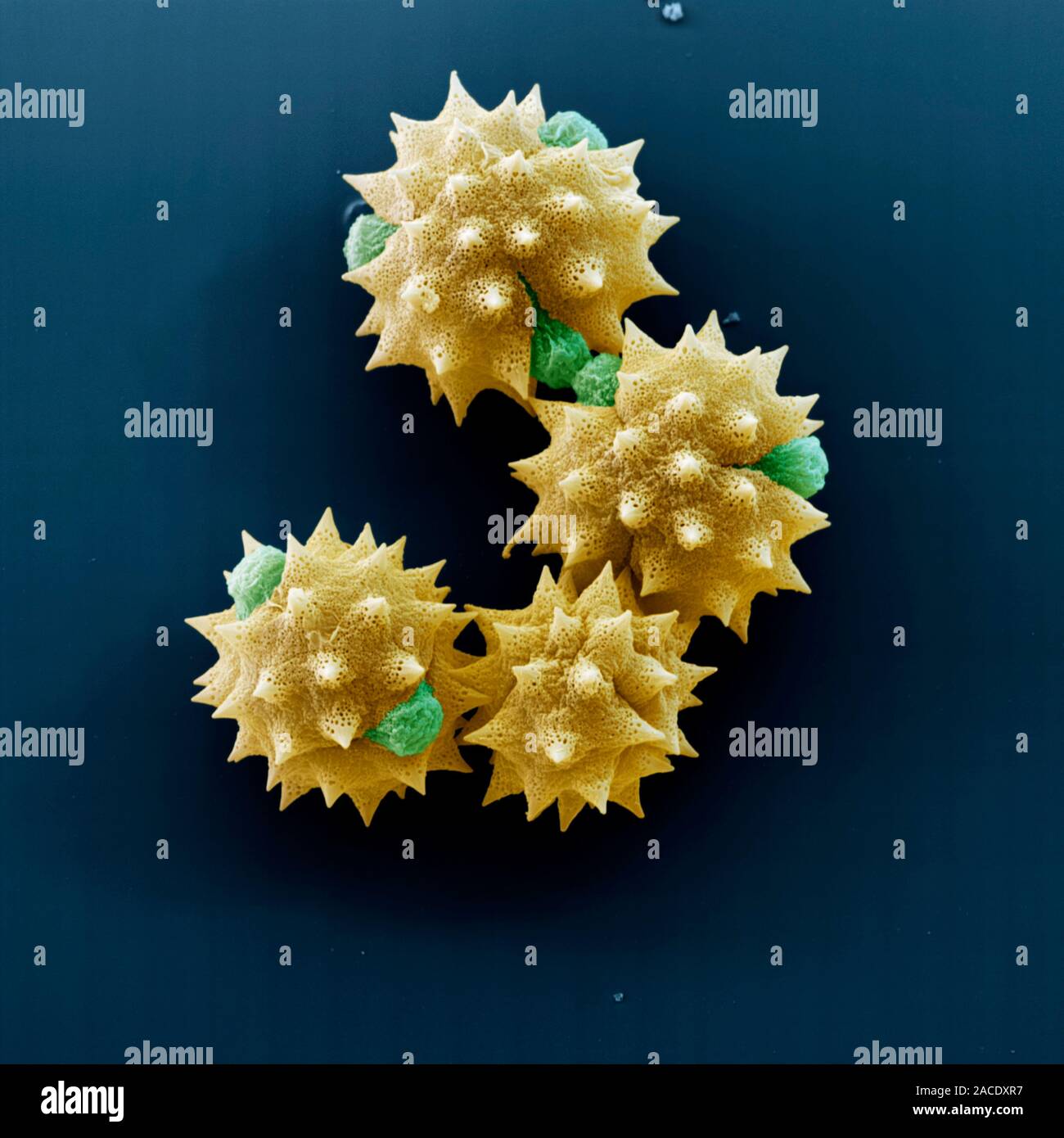 Ox-eye daisy pollen grains. Coloured scanning electron micrograph (SEM ...