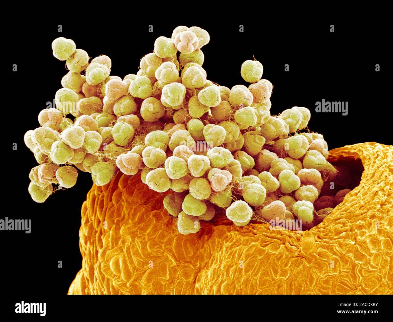 Pollen. Coloured scanning electron micrograph (SEM) of pollen grains ...