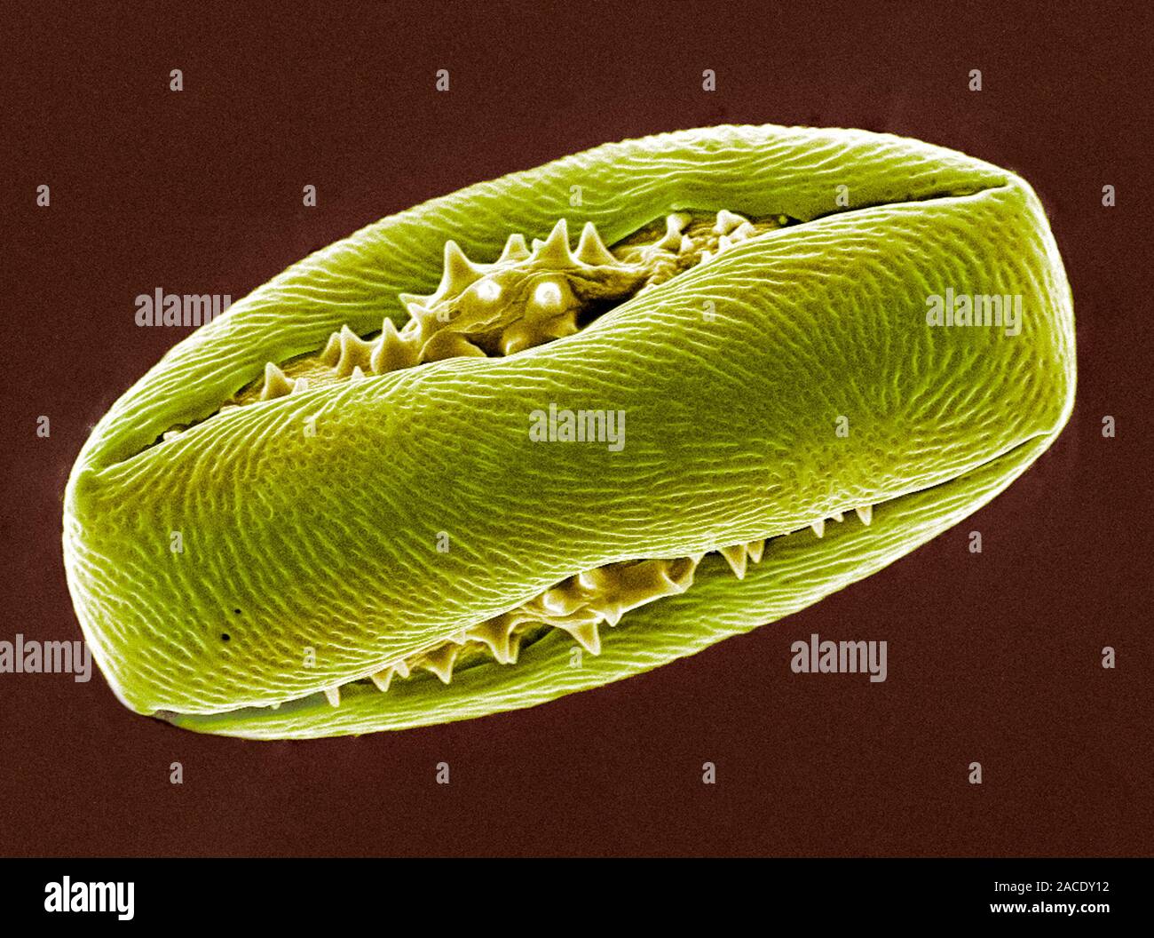 Horse chestnut pollen grain. Coloured scanning electron micrograph (SEM ...