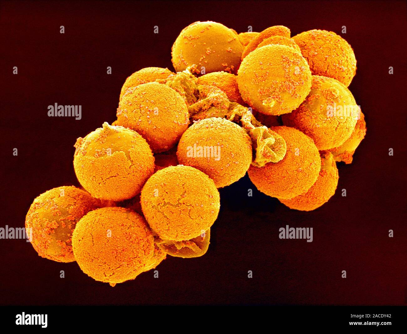 Cedar Pollen Coloured Scanning Electron Micrograph Sem Of Pollen Grains From A Cedar Tree