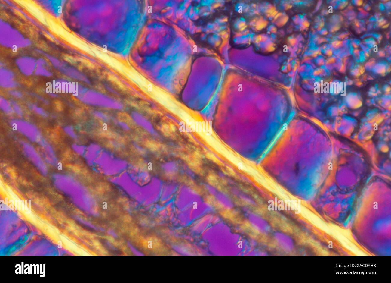 Wheat grain. Light micrograph of a thin section through a grain (seed ...