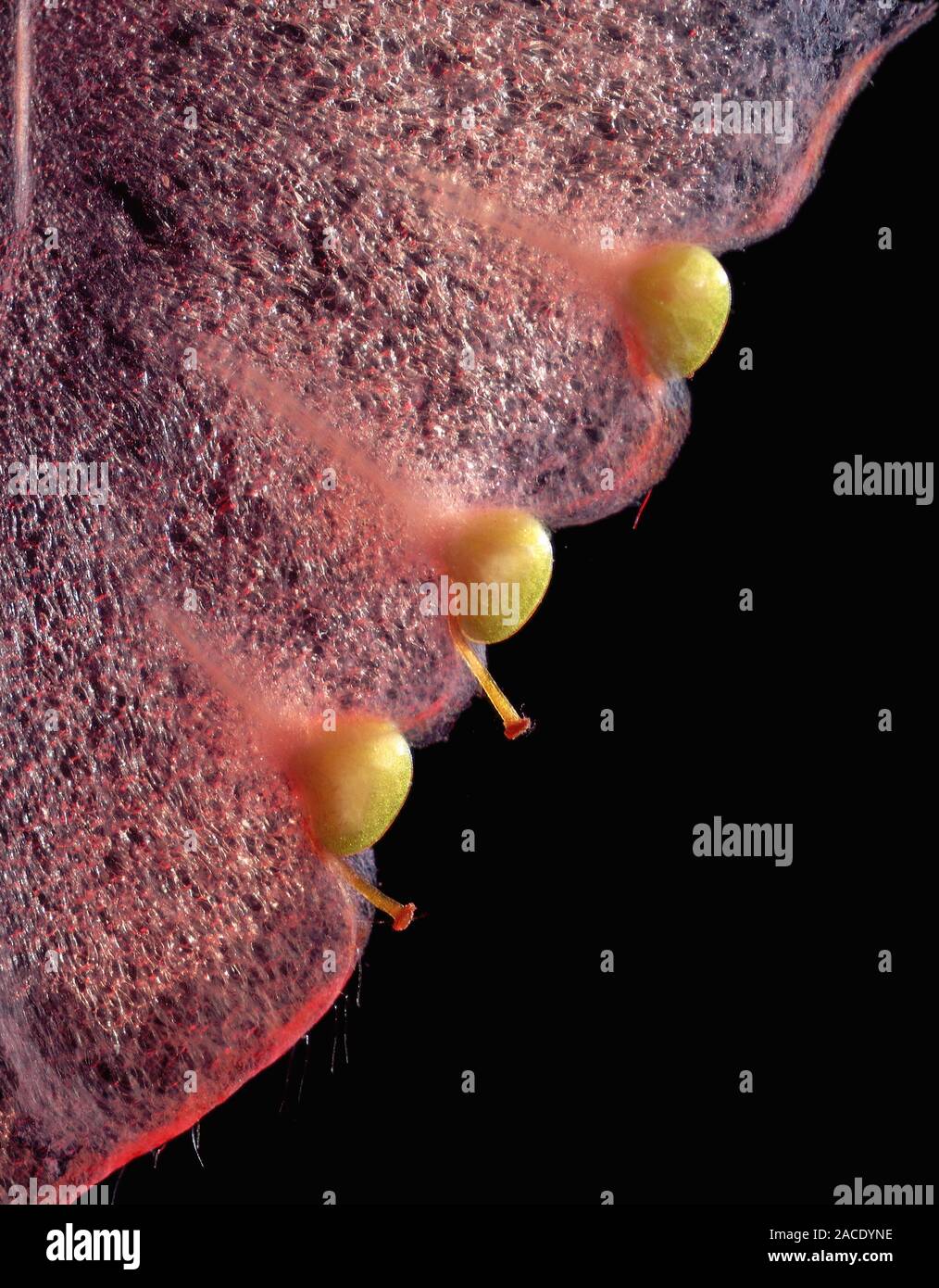 Strawberry. Light micrograph of part of a thinly sliced section through ...