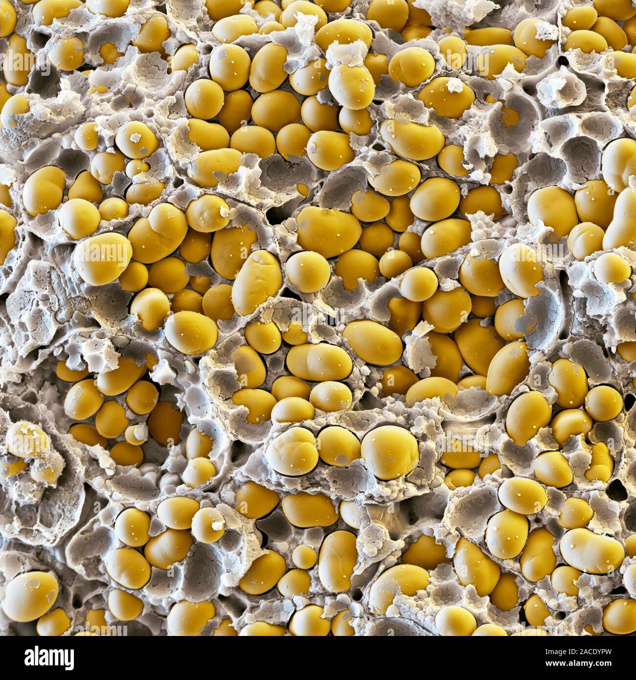 Soya bean. Coloured scanning electron micrograph (SEM) of a section ...