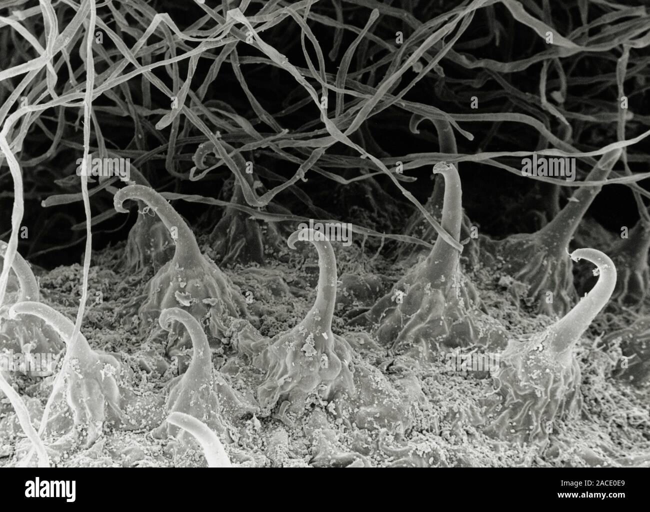 Scanning electron micrograph of a hooked fruit of cleavers or ...