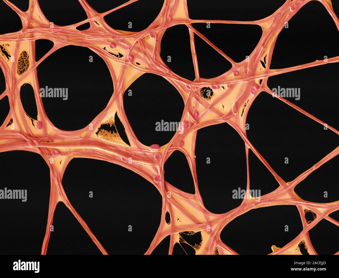 Chinese lantern flower skeleton. Coloured scanning electron micrograph ...