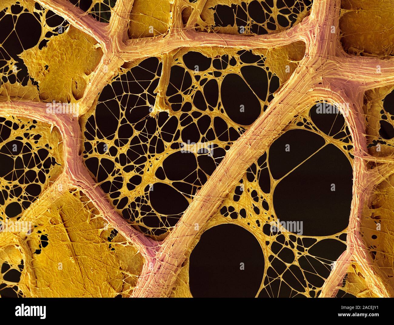 Chinese lantern flower skeleton. Coloured scanning electron micrograph ...