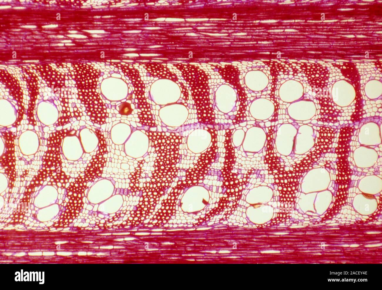 Wood vascular bundle. Light micrograph of a transverse section of a ...