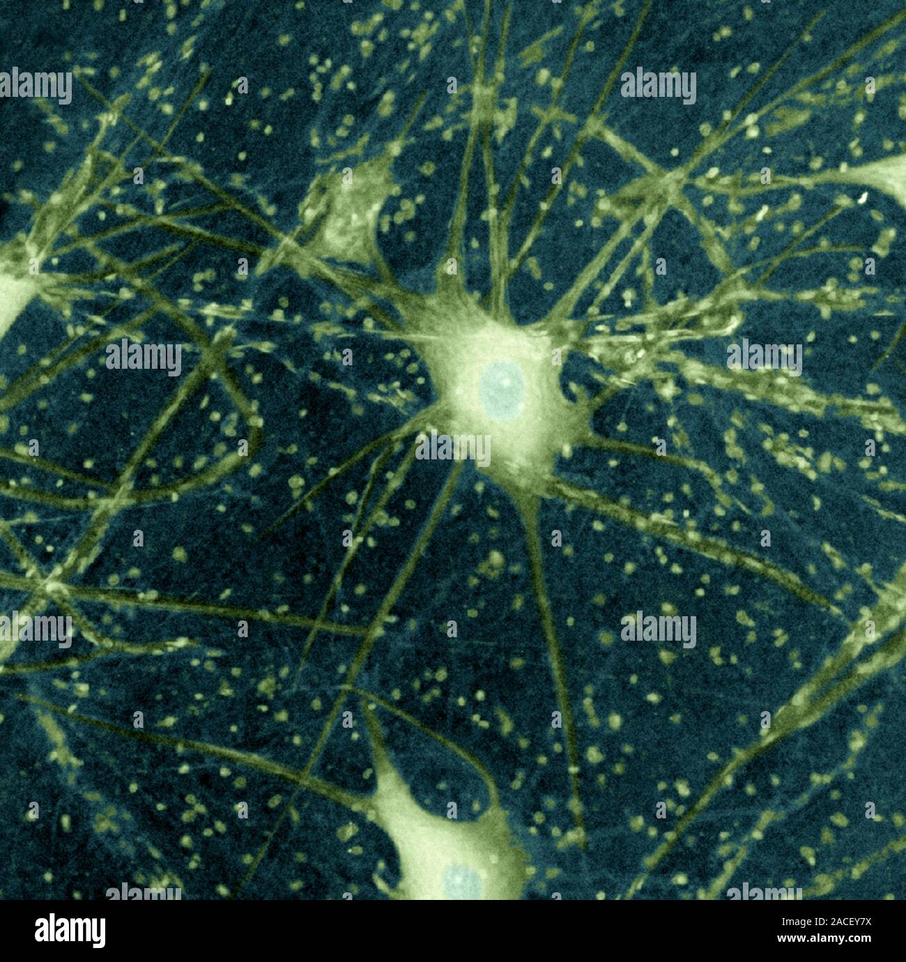 Motor neurons, light micrograph. Motor neurons are responsible for ...