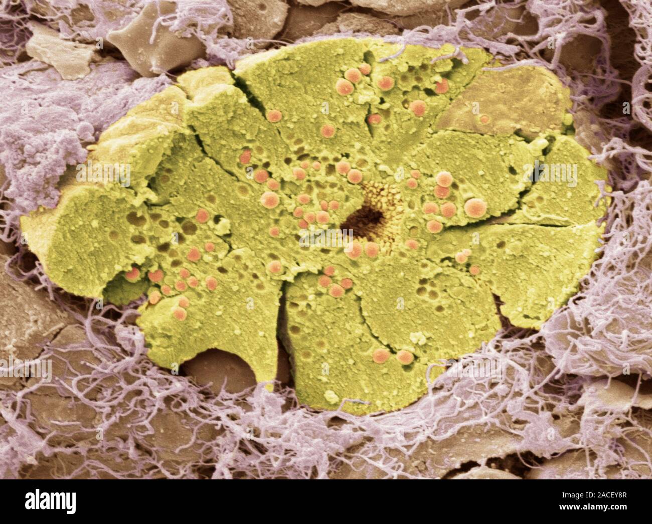 Pancreas acinus. Coloured scanning electron micrograph (SEM) of a ...