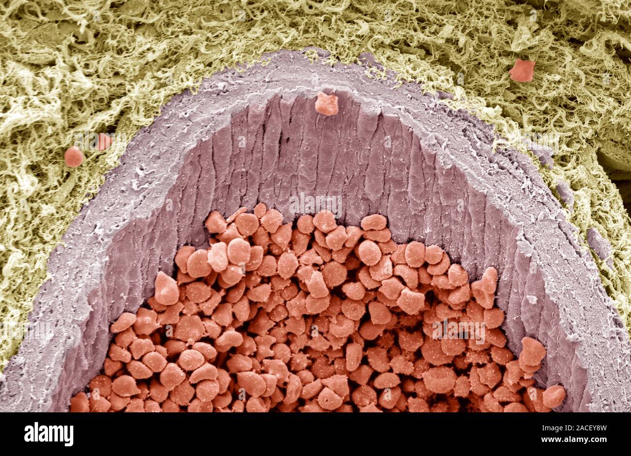 Blood-filled foetal aorta. Coloured scanning electron micrograph (SEM ...