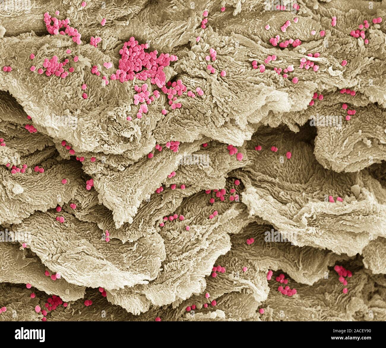 Athlete's foot. Coloured scanning electron micrograph (SEM) of spores ...