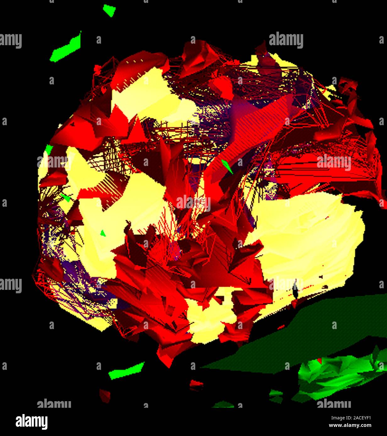 Defensin in a skin cell, 3D fluorescence deconvolution micrograph ...