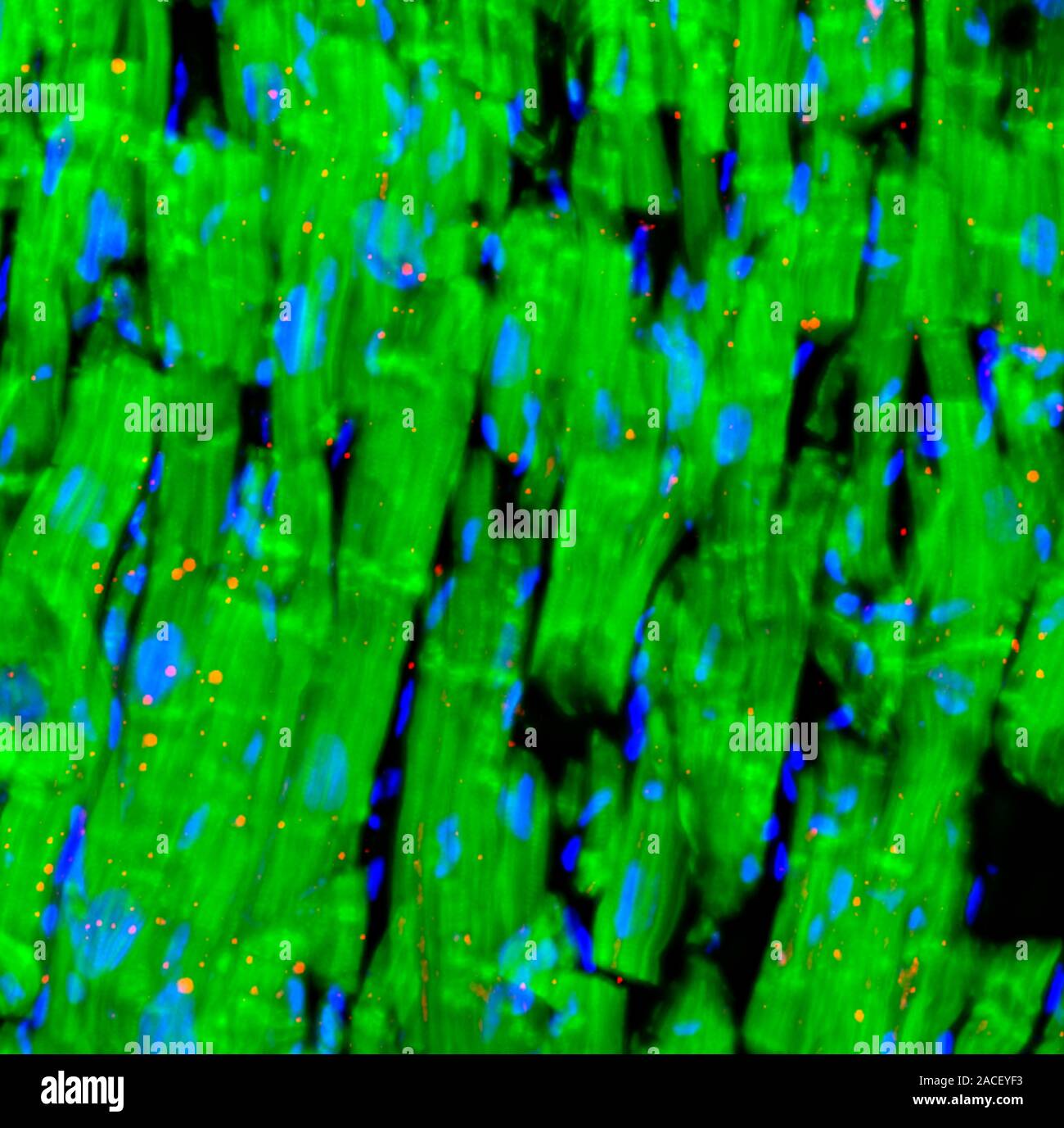 Heart muscle. Fluorescence deconvolution micrograph of a section ...