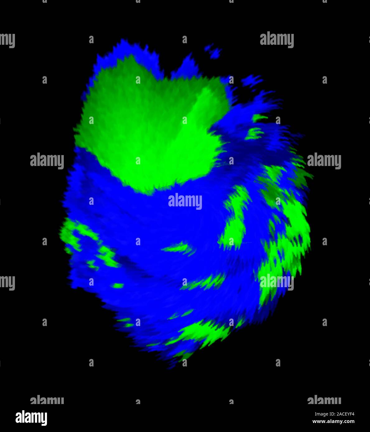 White blood cell, 3D fluorescence deconvolution micrograph. Stacked ...