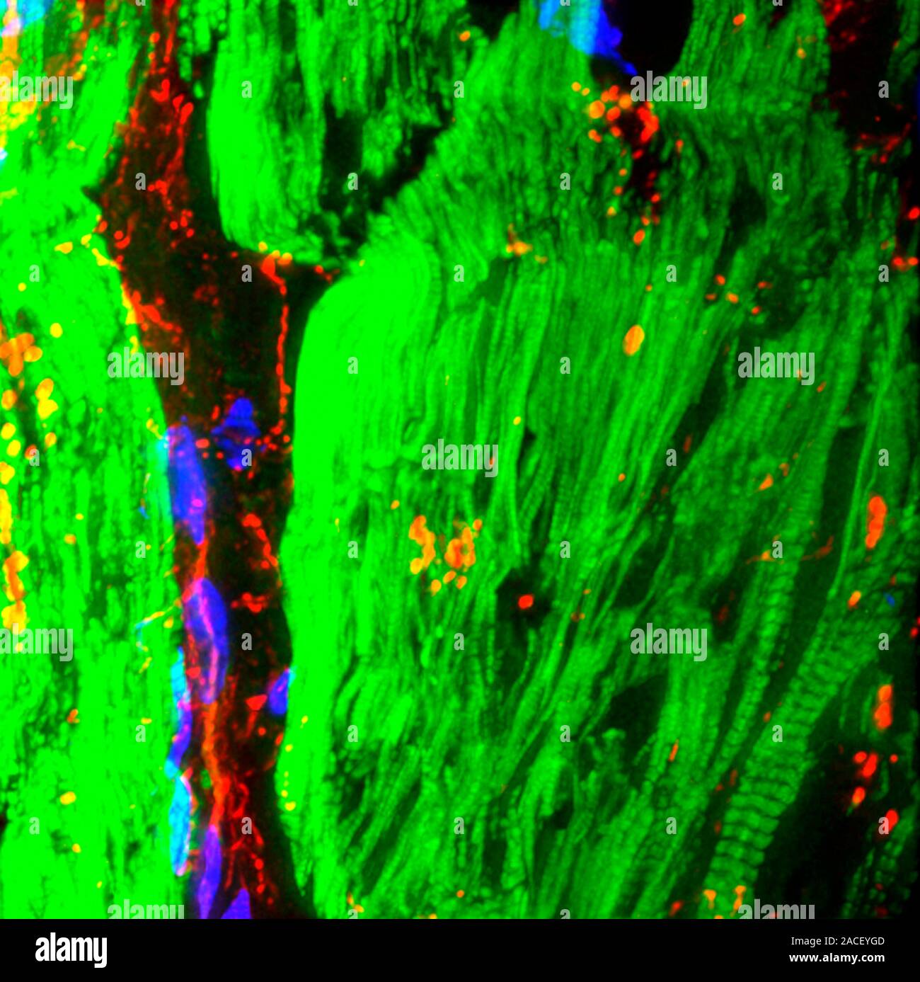 Transcription factor in heart muscle. Fluorescence deconvolution ...