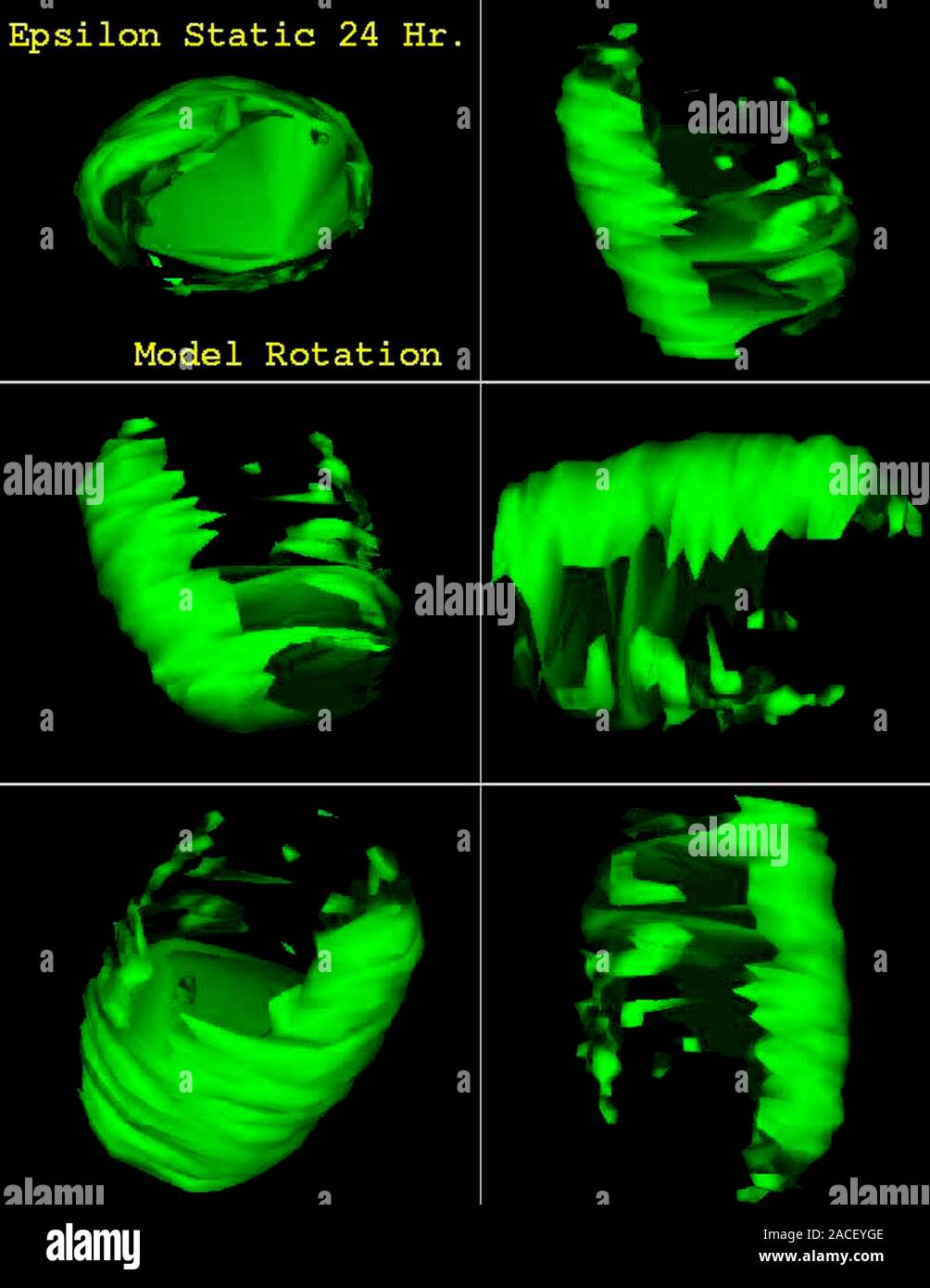 White blood cell enzyme. Series of stacked fluorescence deconvolution micrographs, giving a 3 ...