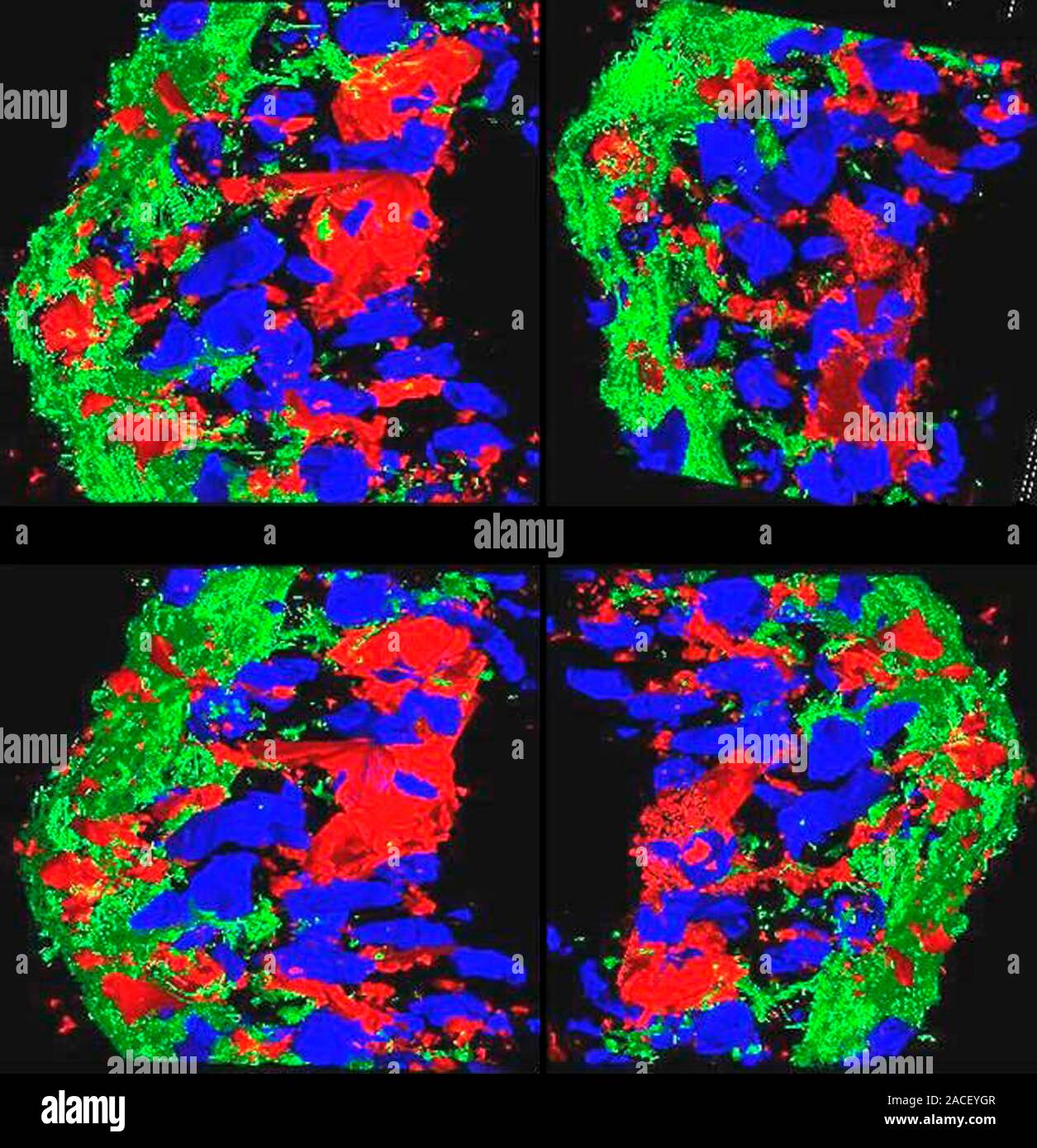 Human skin, 3D fluorescence deconvolution micrograph. Four different ...