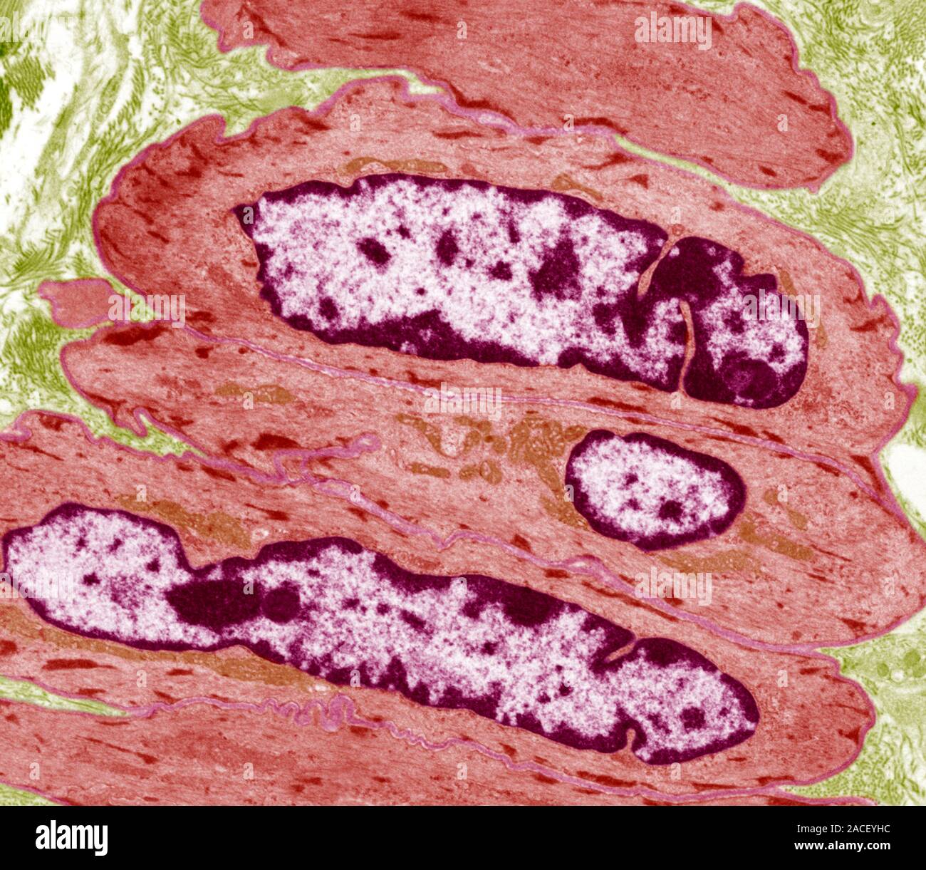 Intestinal smooth muscle cells. Coloured transmission electron ...