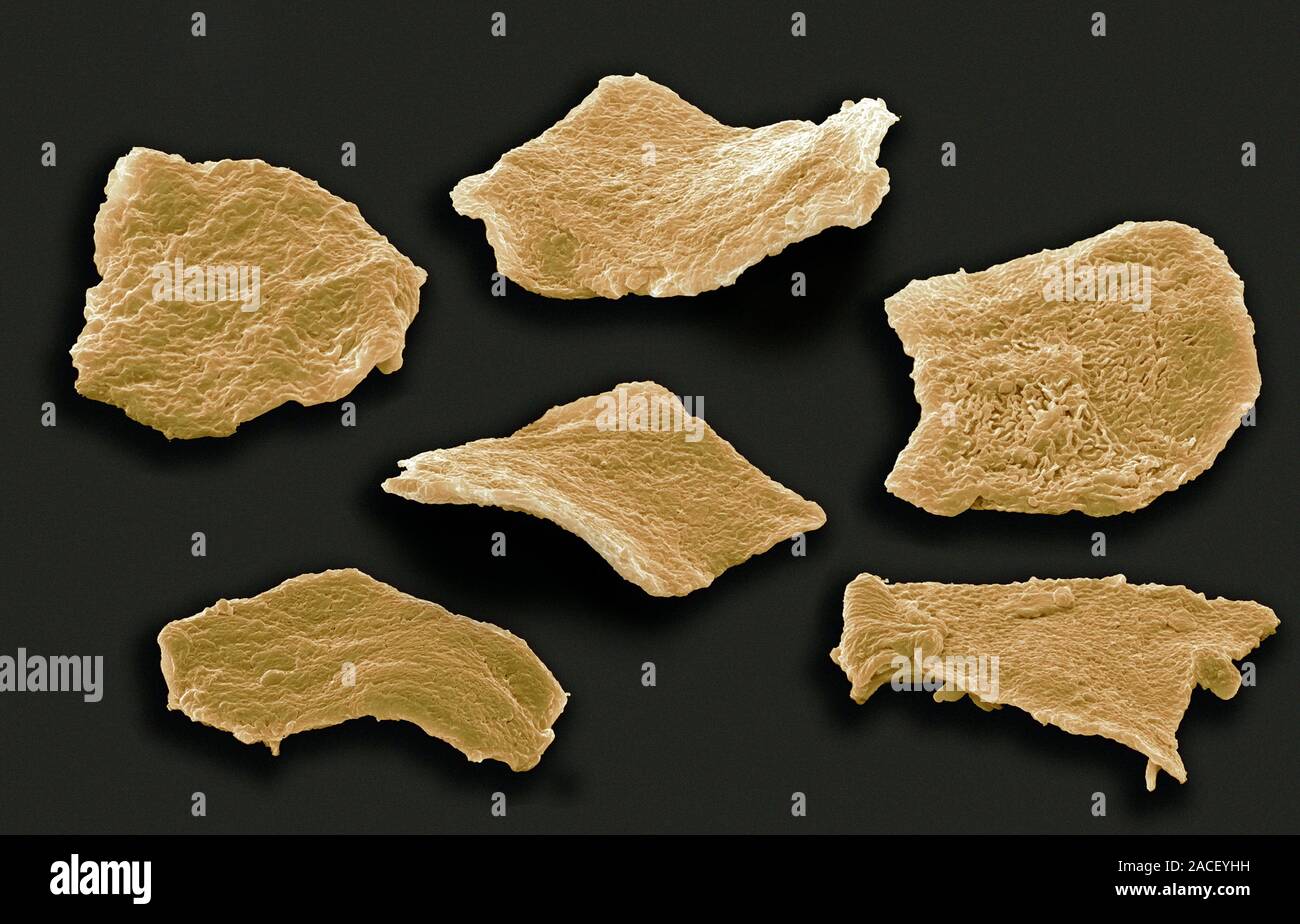 Cheek squamous cells. Coloured scanning electron micrograph (SEM) of ...