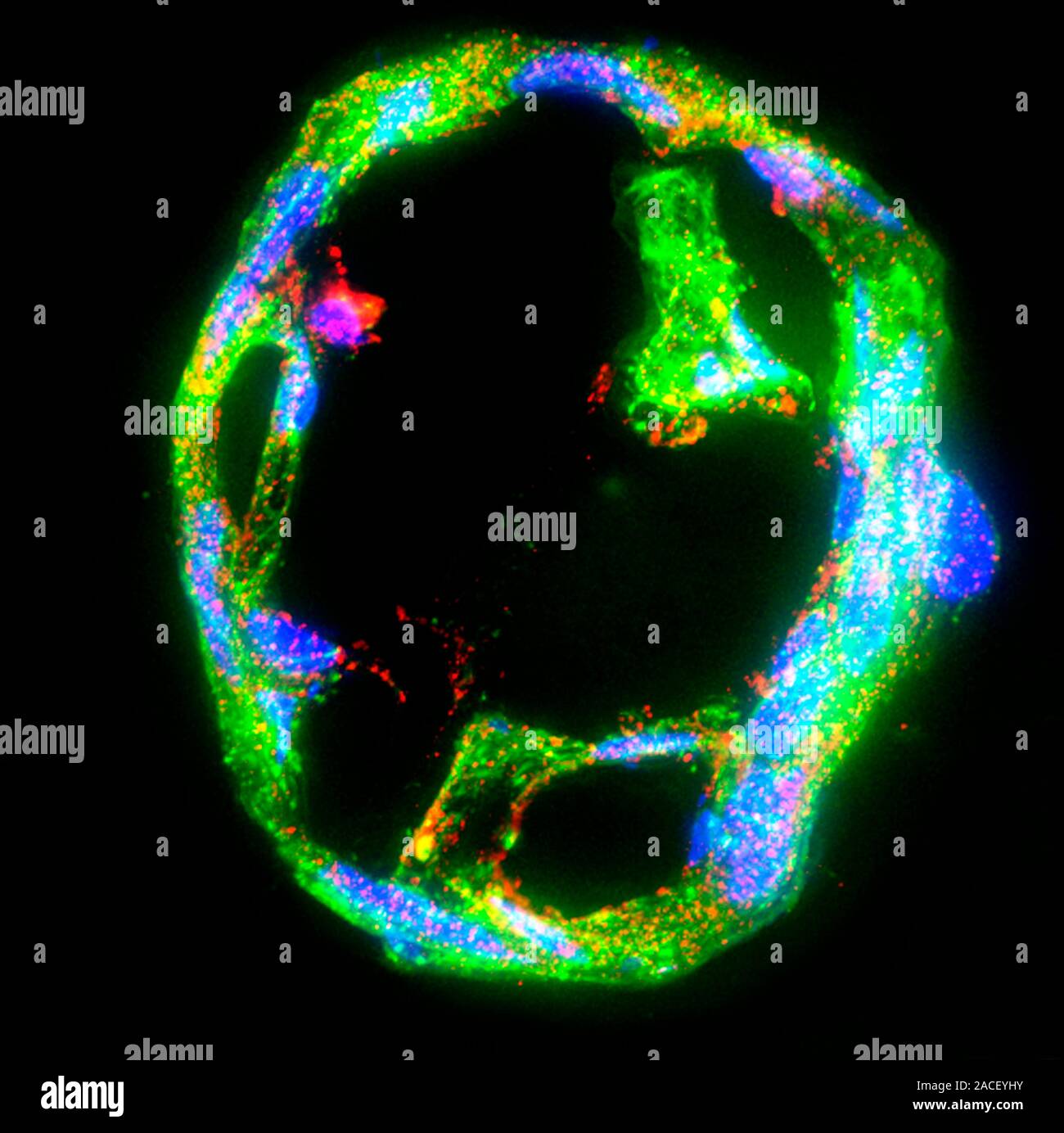 Placental tissue. Fluorescence deconvolution micrograph of a ...
